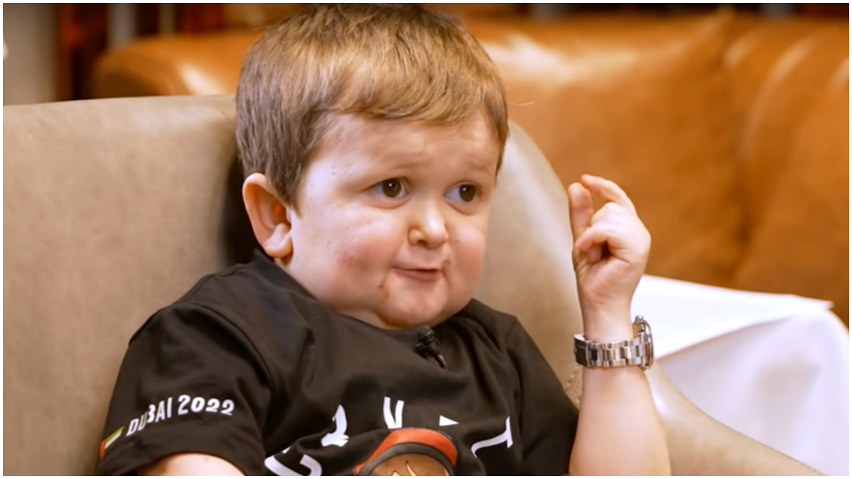 Hasbulla Says He Is More Popular Than Cristiano Ronaldo | MiddleEasy