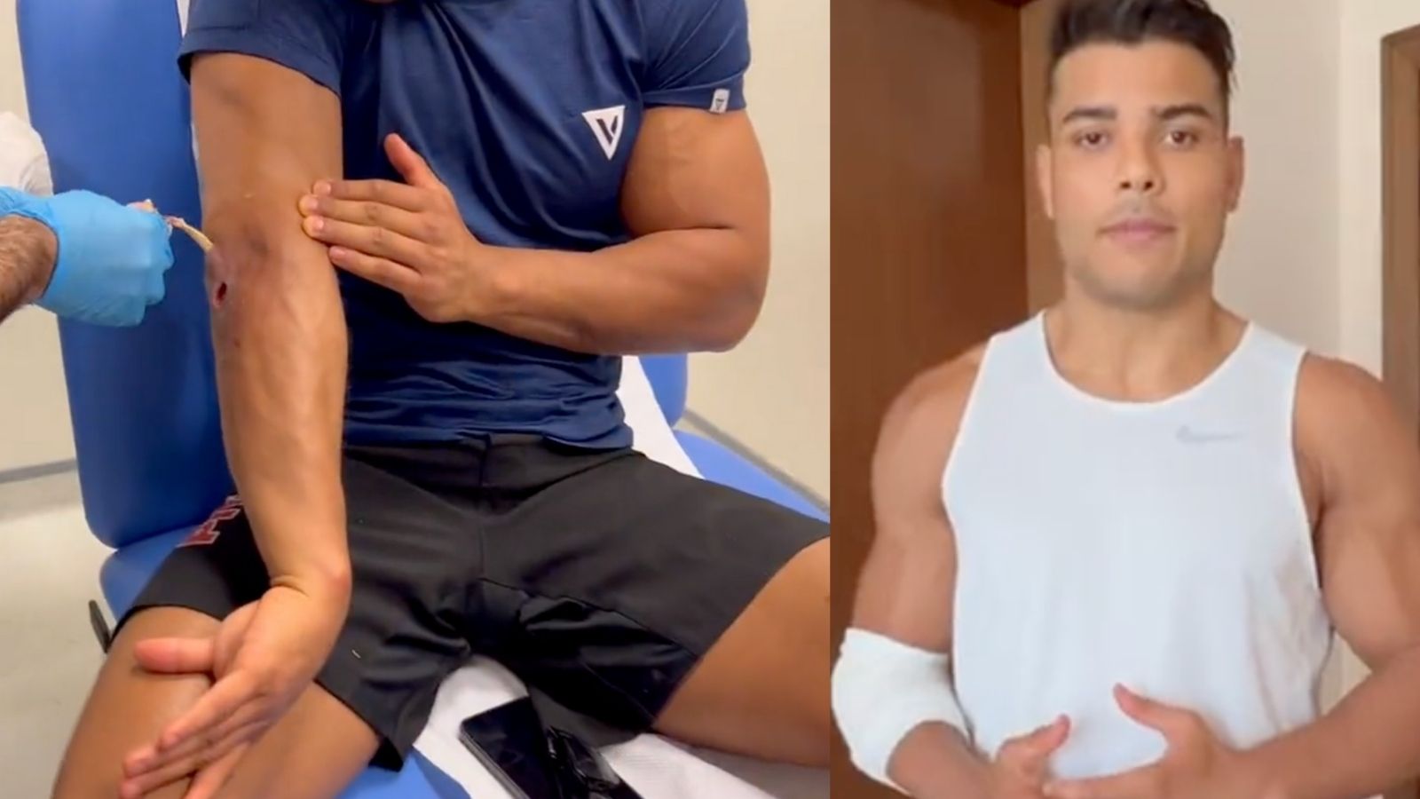 PHOTO: Paulo Costa's Gruesome Infection That Forced Him To Withdraw ...