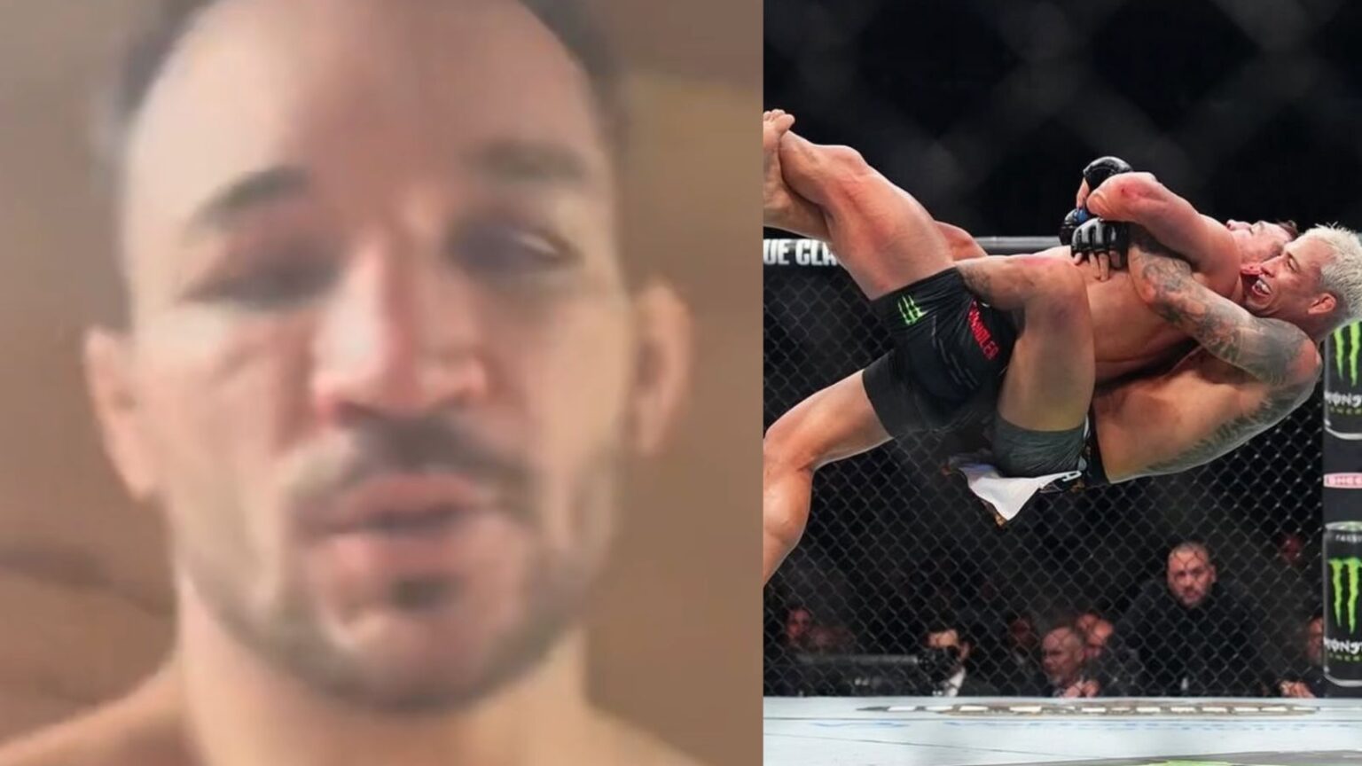 Michael Chandler Shows Off Scars from UFC 309 Battle with Charles ...