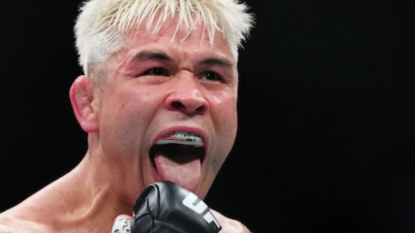 Dana White Posts Graphic Photos of Ricky Simon’s Chin Injury After UFC ...